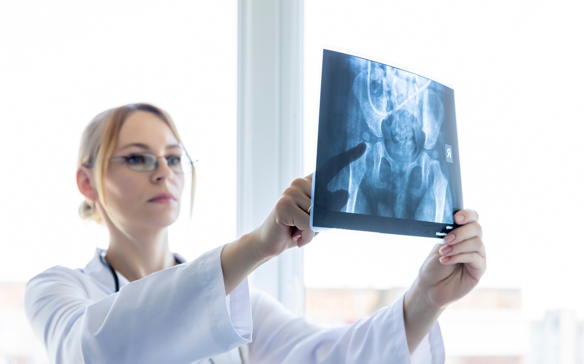 Types of Defective Hip Complications | Morris Law Firm